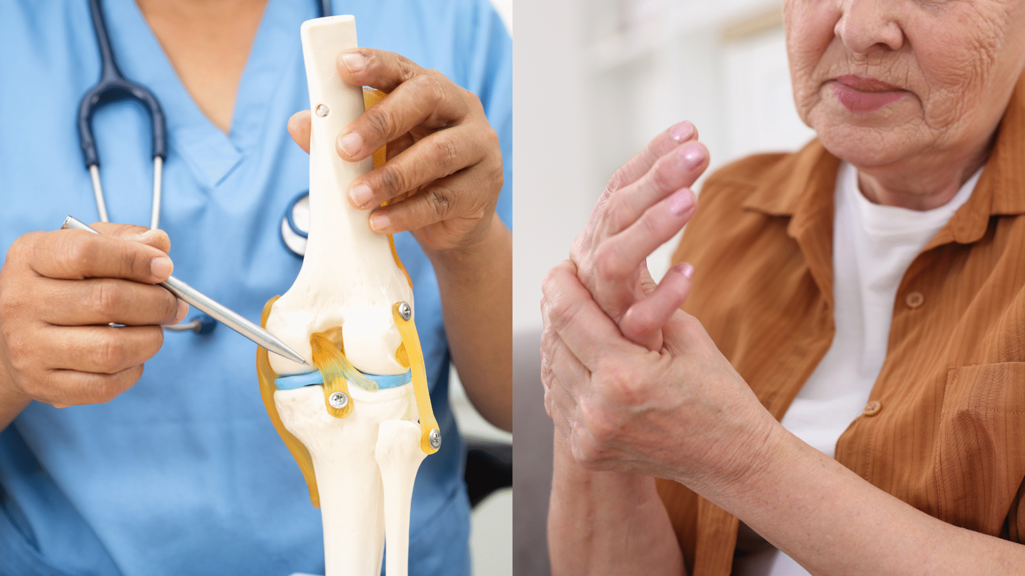 Arthritis vs Osteoarthritis: Key Differences